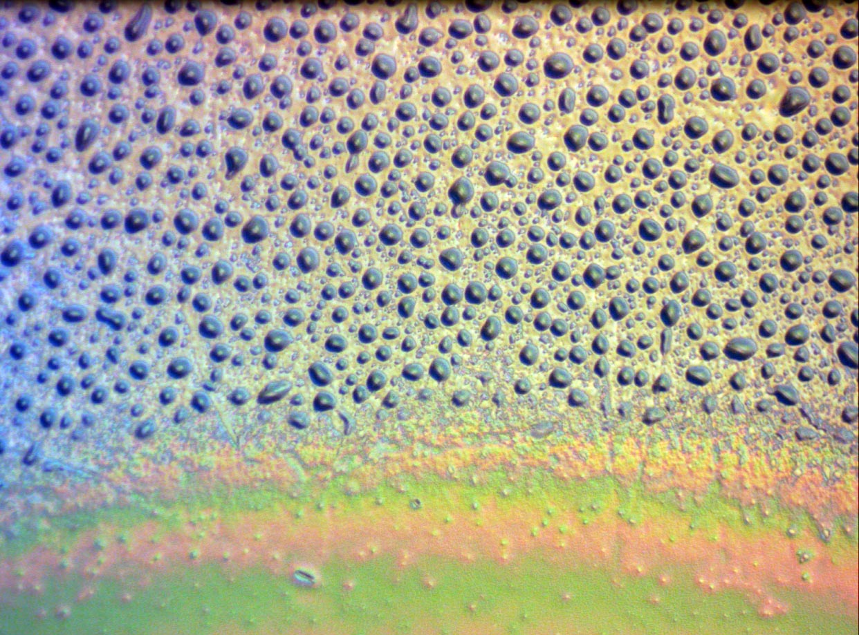 Differential Interference Contrast Microscopy