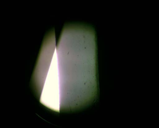 Hoffman Modulation Contrast Microscopy